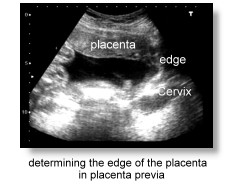 What are Obstetric Ultrasound Scans? - HelpingTeens.org